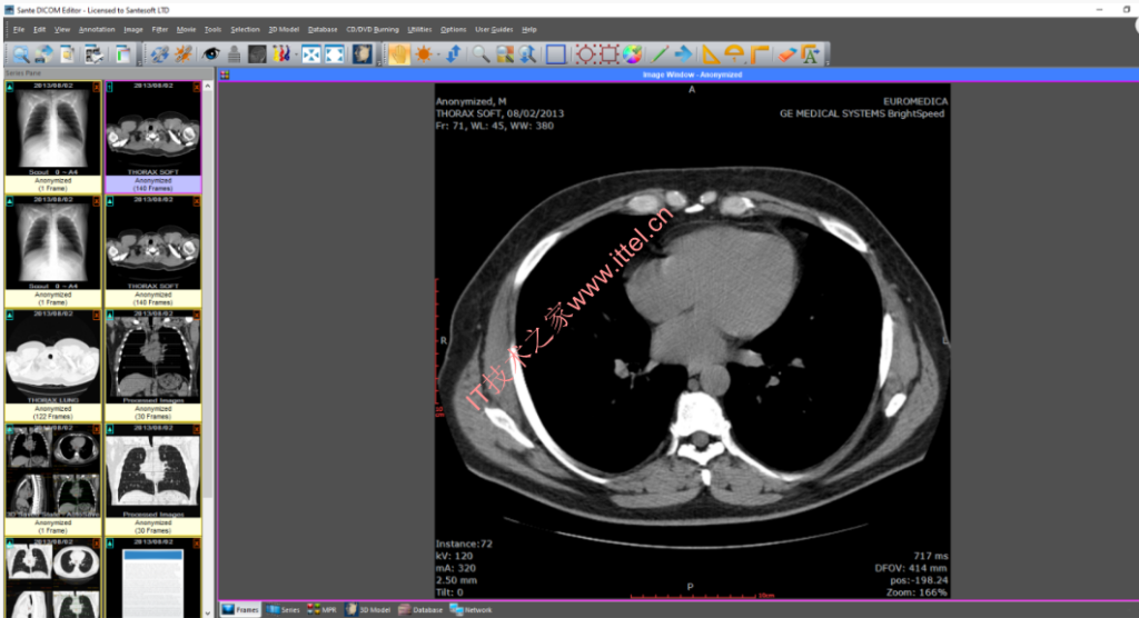 医学影像编辑器 Sante DICOM Editor v8.2.5 安装激活教程