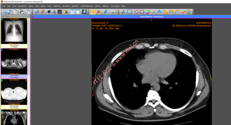 医学影像查看器 Sante DICOM Viewer Pro v12.2.5 安装激活教程